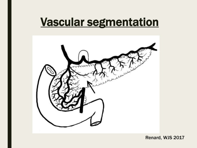 Pancreas anatomy for experts by Dr Harsh Shah(www.gastroclinix.com) | PPT