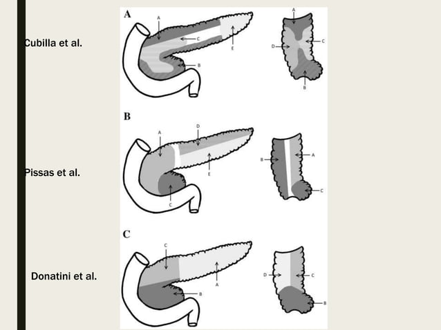 Pancreas anatomy for experts by Dr Harsh Shah(www.gastroclinix.com) | PPT