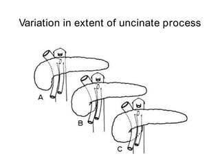 Pancreas anatomy for experts by Dr Harsh Shah(www.gastroclinix.com) | PPTX