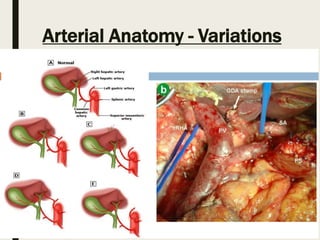 Pancreas anatomy for experts by Dr Harsh Shah(www.gastroclinix.com) | PPTX
