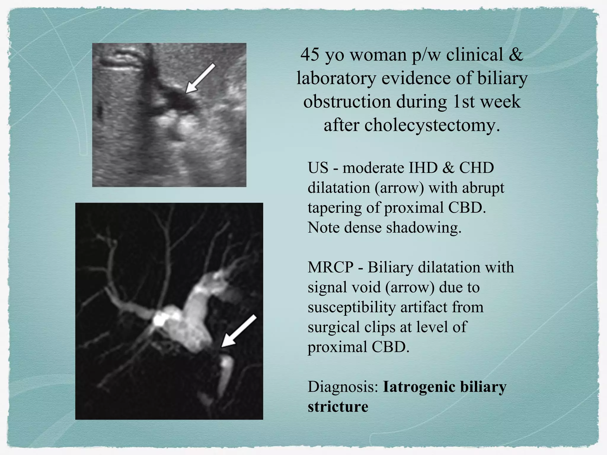 Pancreas and spleen 04022021 | PDF