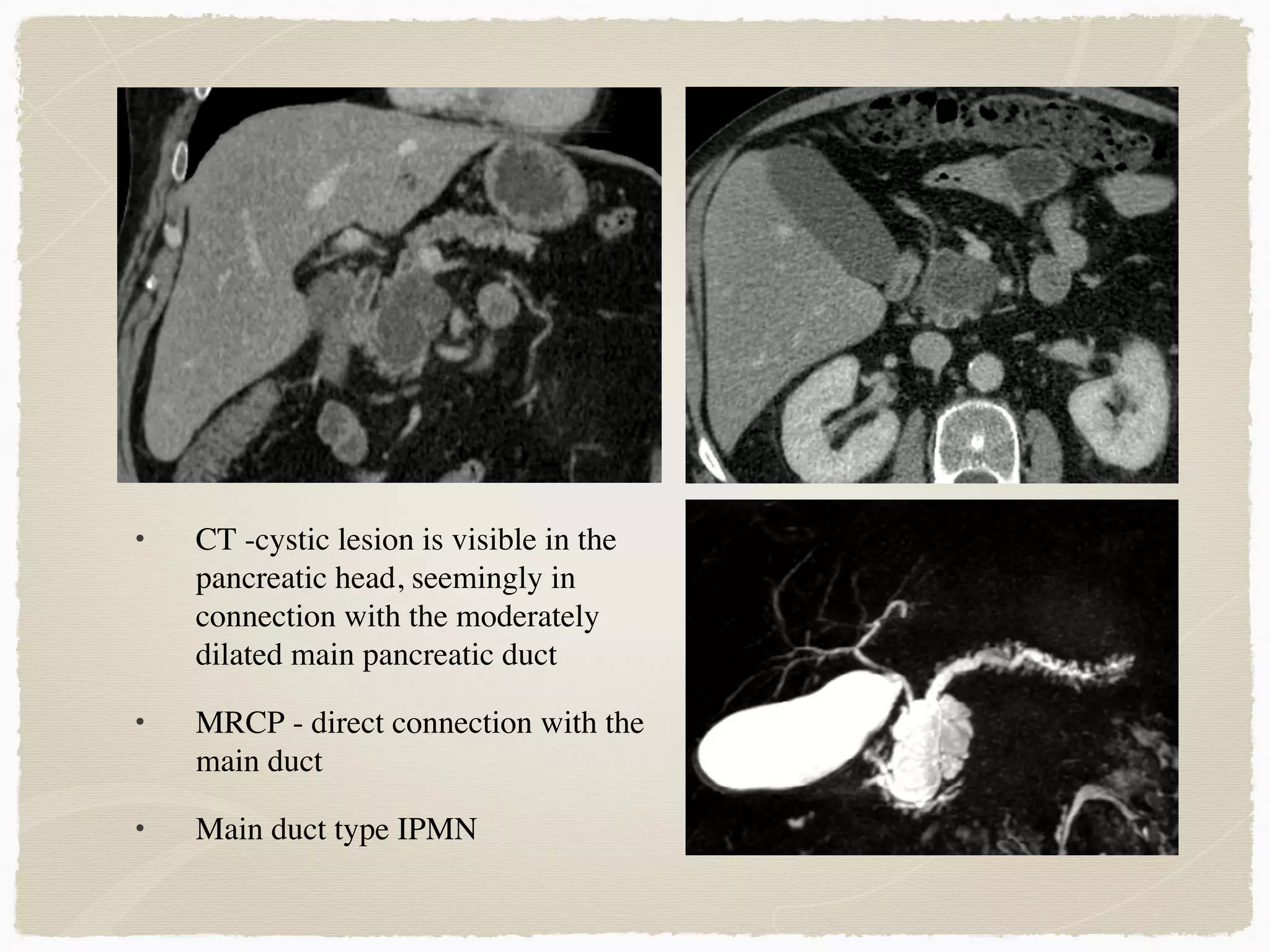 Pancreas and spleen 04022021 | PDF
