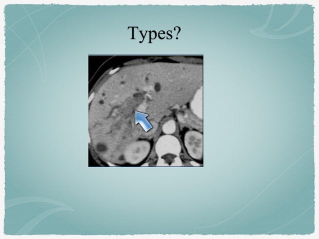 Pancreas and spleen 04022021 | PPT
