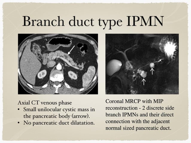 Pancreas and spleen 04022021 | PPT