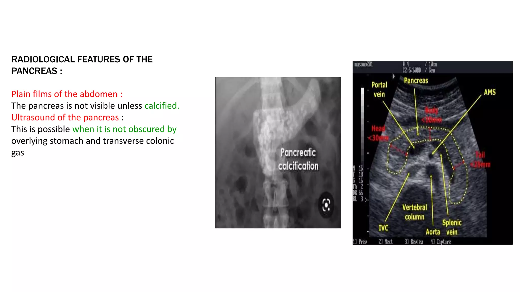 Pancreas and spleen dr aya.pptx