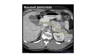 Pancreas and spleen dr aya.pptx