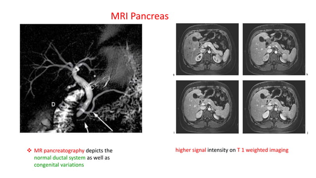 Pancreas and spleen dr aya.pptx