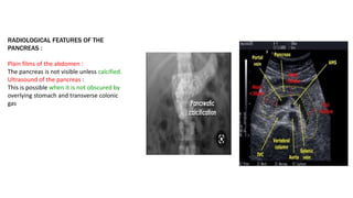 Pancreas and spleen dr aya.pptx