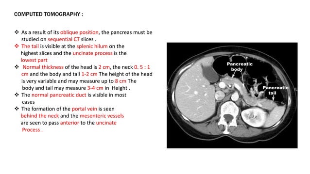 Pancreas and spleen dr aya.pptx