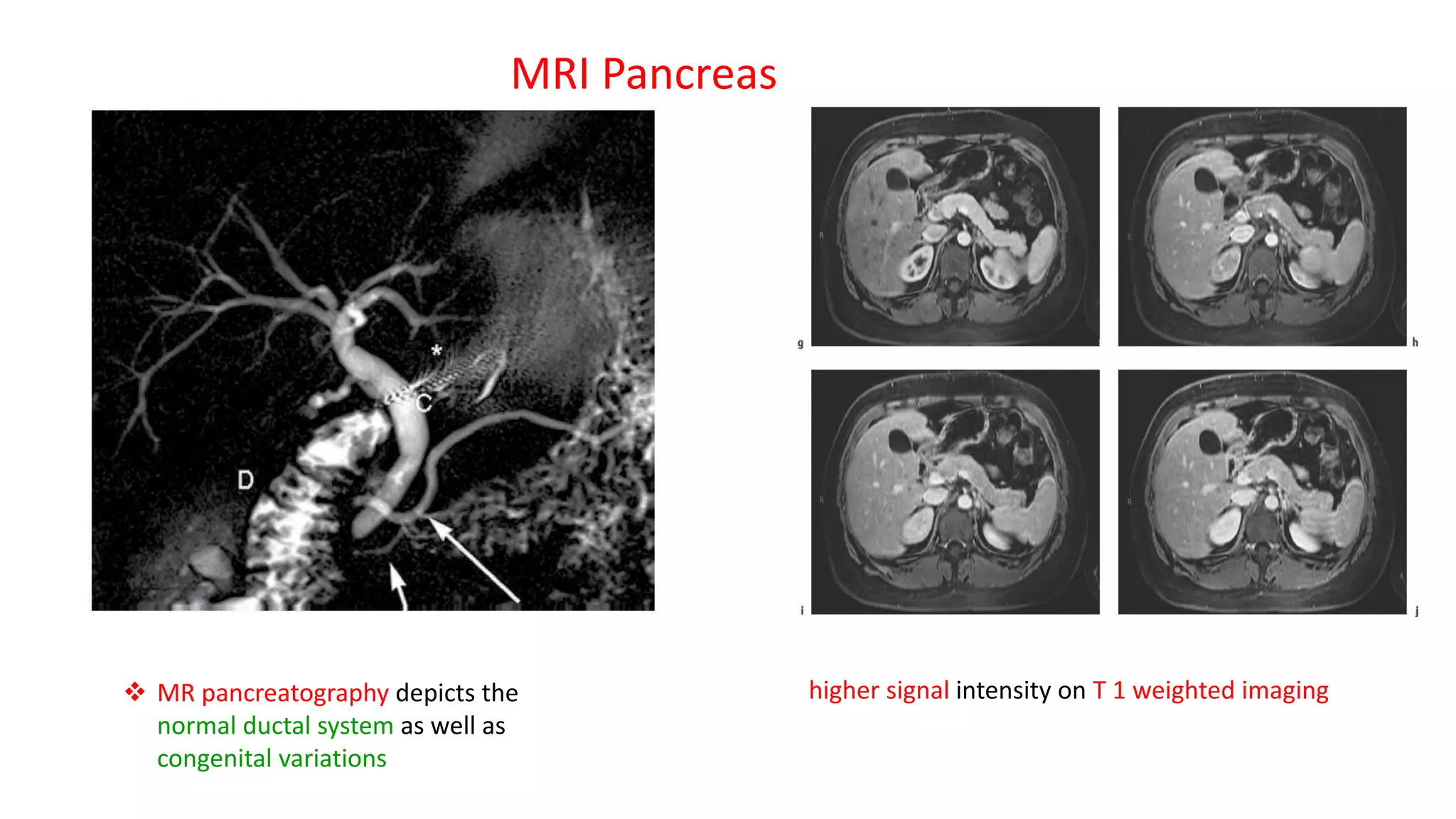 Pancreas and spleen dr aya.pdf