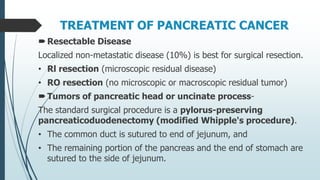 Cancer of Pancreas | PDF