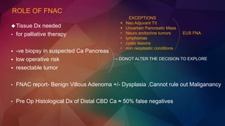 Carcinoma pancreas management | PPTX