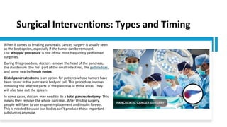 Pancreas Cancer - Symptoms & Treatment Overview.pdf