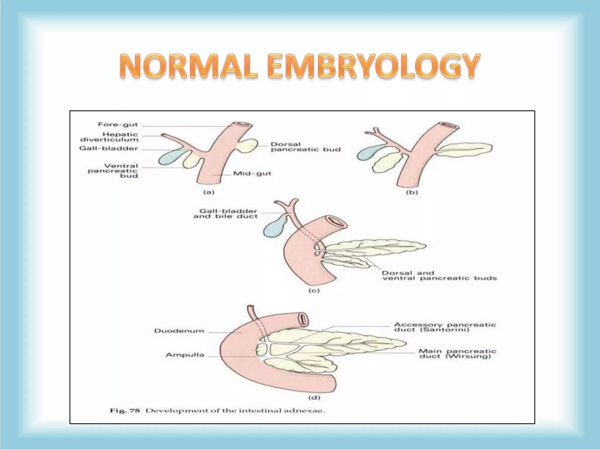 Pancreas Congenital Anomalies (agenesis, pancreas divisum, annular ...