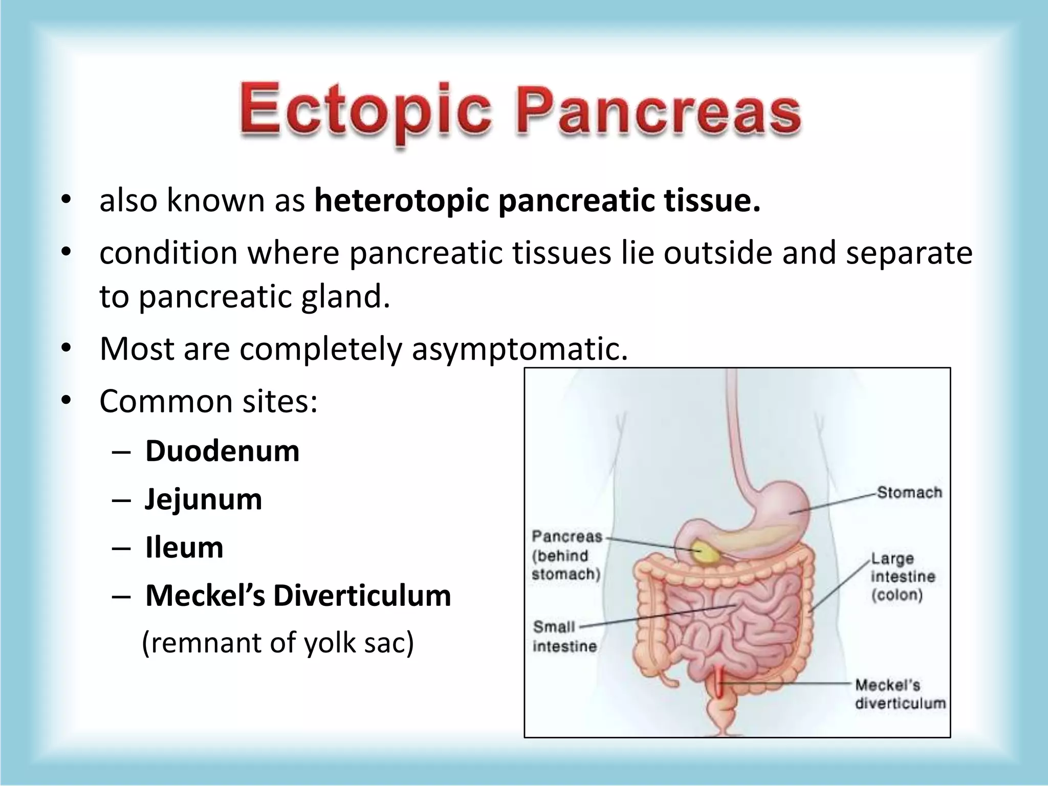 Pancreas Congenital Anomalies (agenesis, pancreas divisum, annular ...