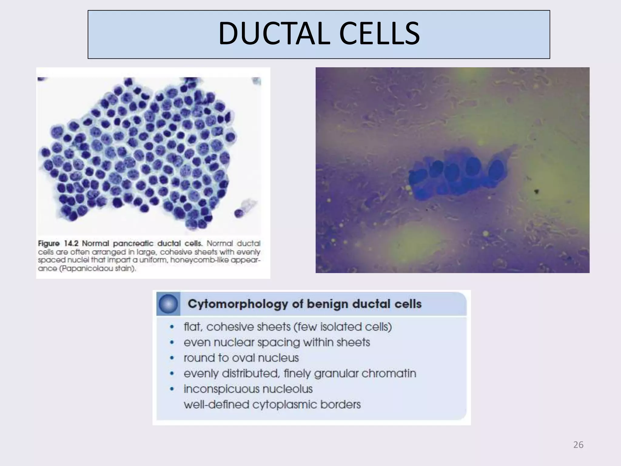 Pancreas cytology | PPTX
