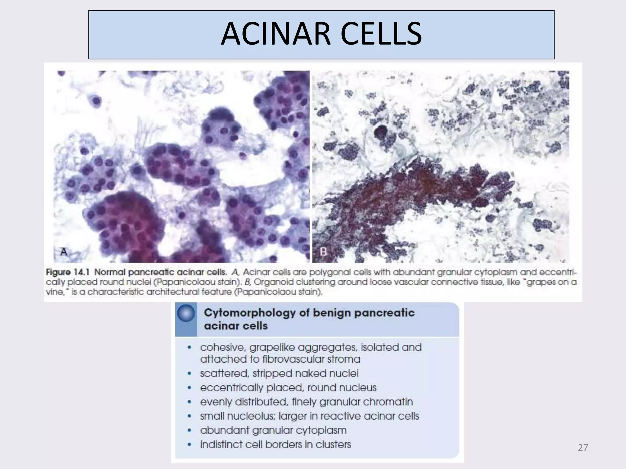 Pancreas cytology | PPTX