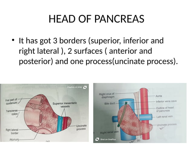 pancrease anatomy and embryology. hope you like it. | PPTX