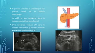 PANCREAS ECOGRAFIA'' ESTADIO DE PANCREATITIS.pptx