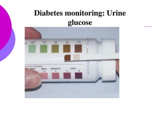 PANCREASE PHYSIOLOGY.pdf | Endocrine and Metabolic Diseases | Diseases and Conditions