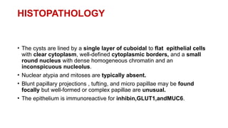 PANCREAS EPITHELIAL TUMORS pancreas epithelial tumor | PPTX