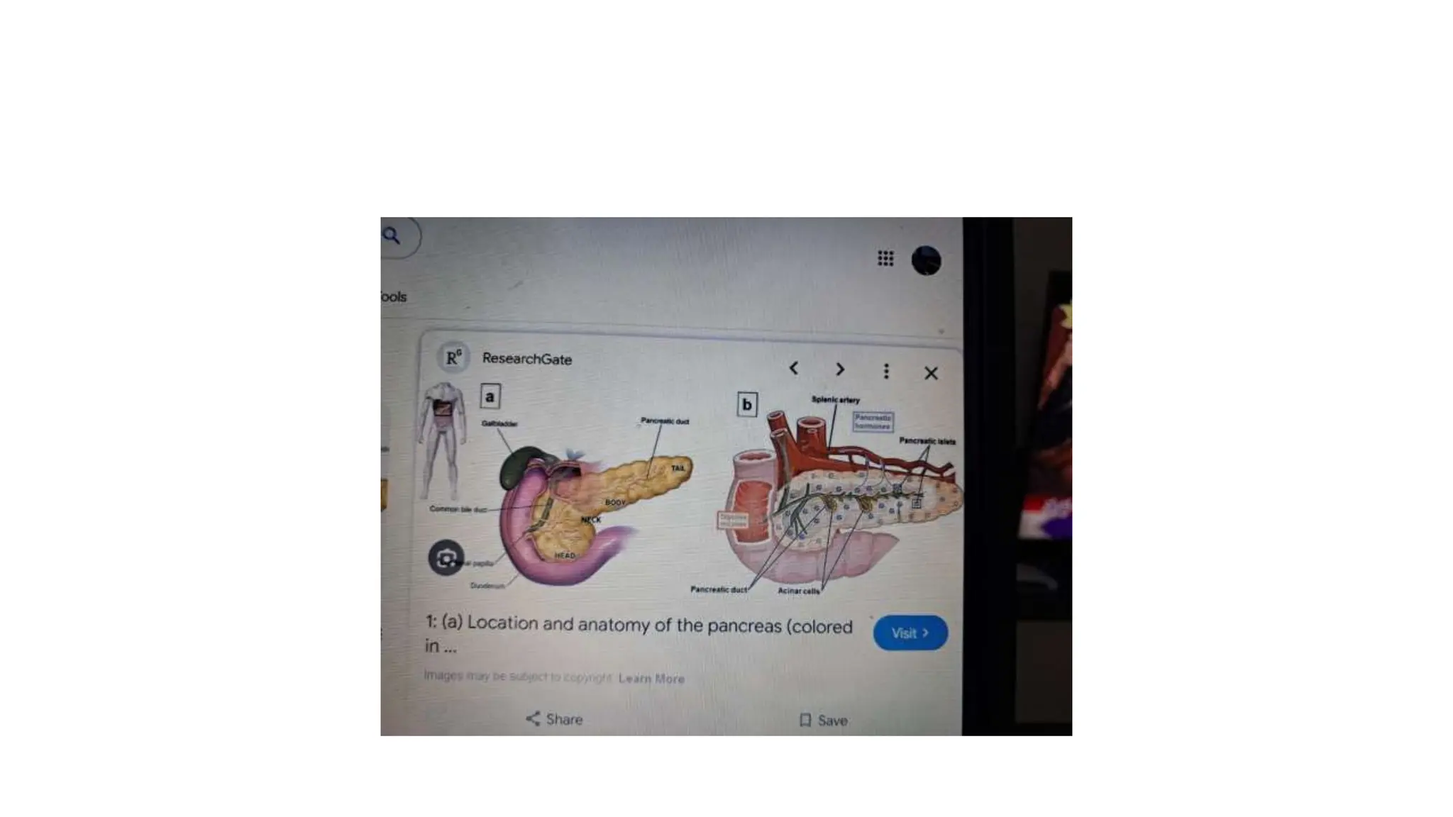 Pancreas_functional anatomy_enzymes.pptx