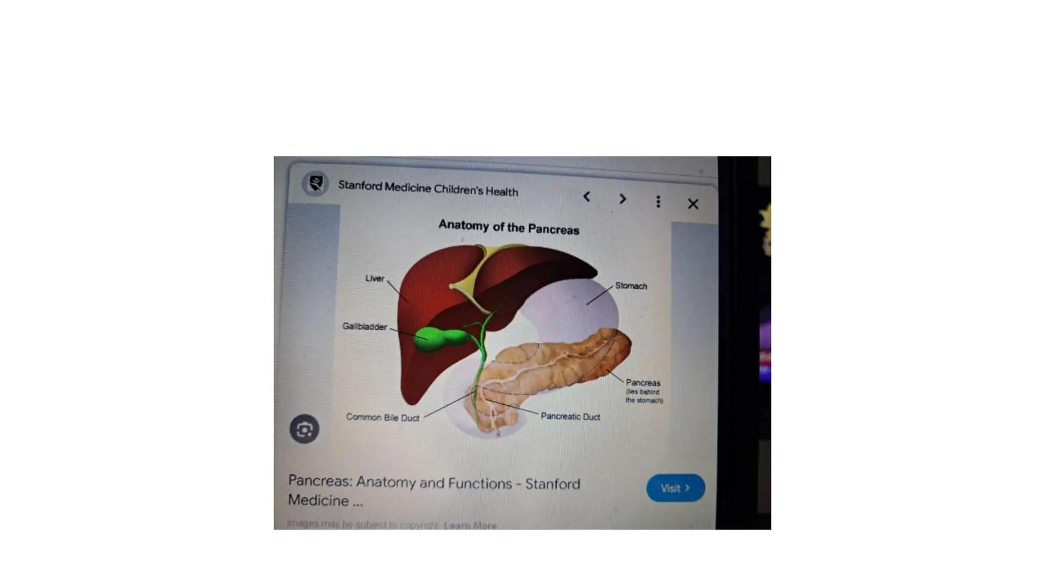 Pancreas_functional anatomy_enzymes.pptx