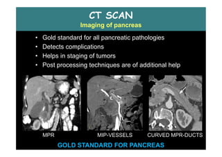 Imaging of the Pancreas | PDF
