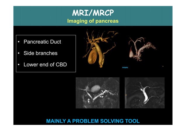 Imaging of the Pancreas | PDF | Endocrine and Metabolic Diseases ...