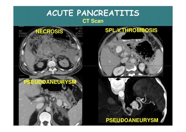 Imaging of the Pancreas