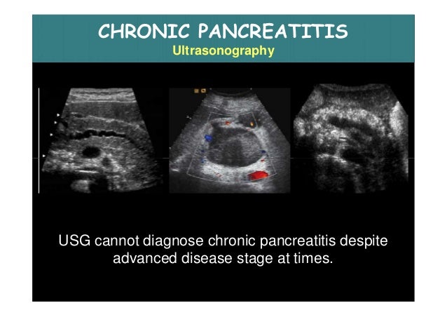 Imaging of the Pancreas