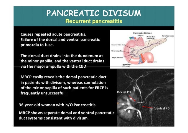 Imaging of the Pancreas