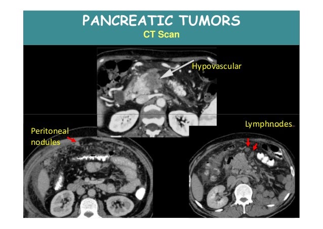 Imaging of the Pancreas