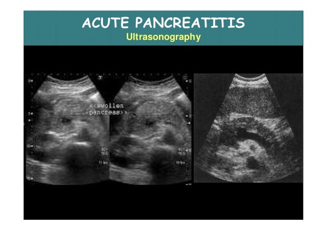Imaging of the Pancreas