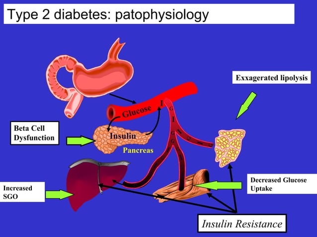 Pancreas lec | PPT