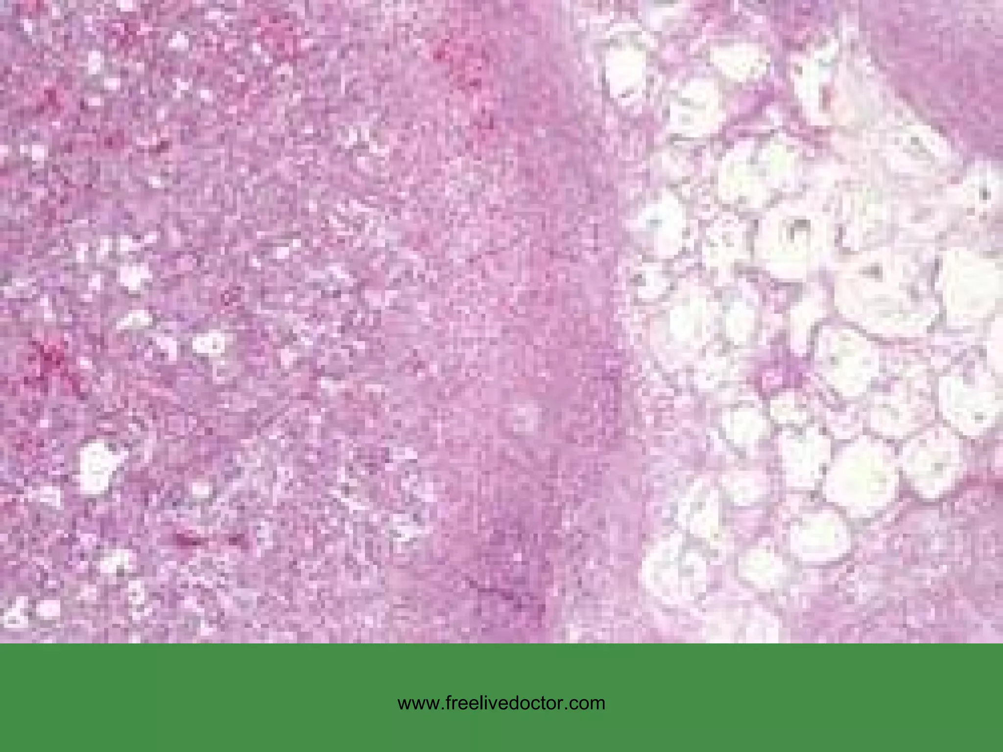 Pancreas pathology | PPT