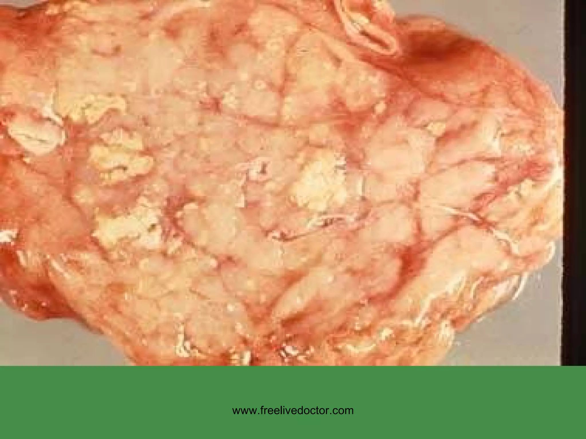 Pancreas pathology | PPT