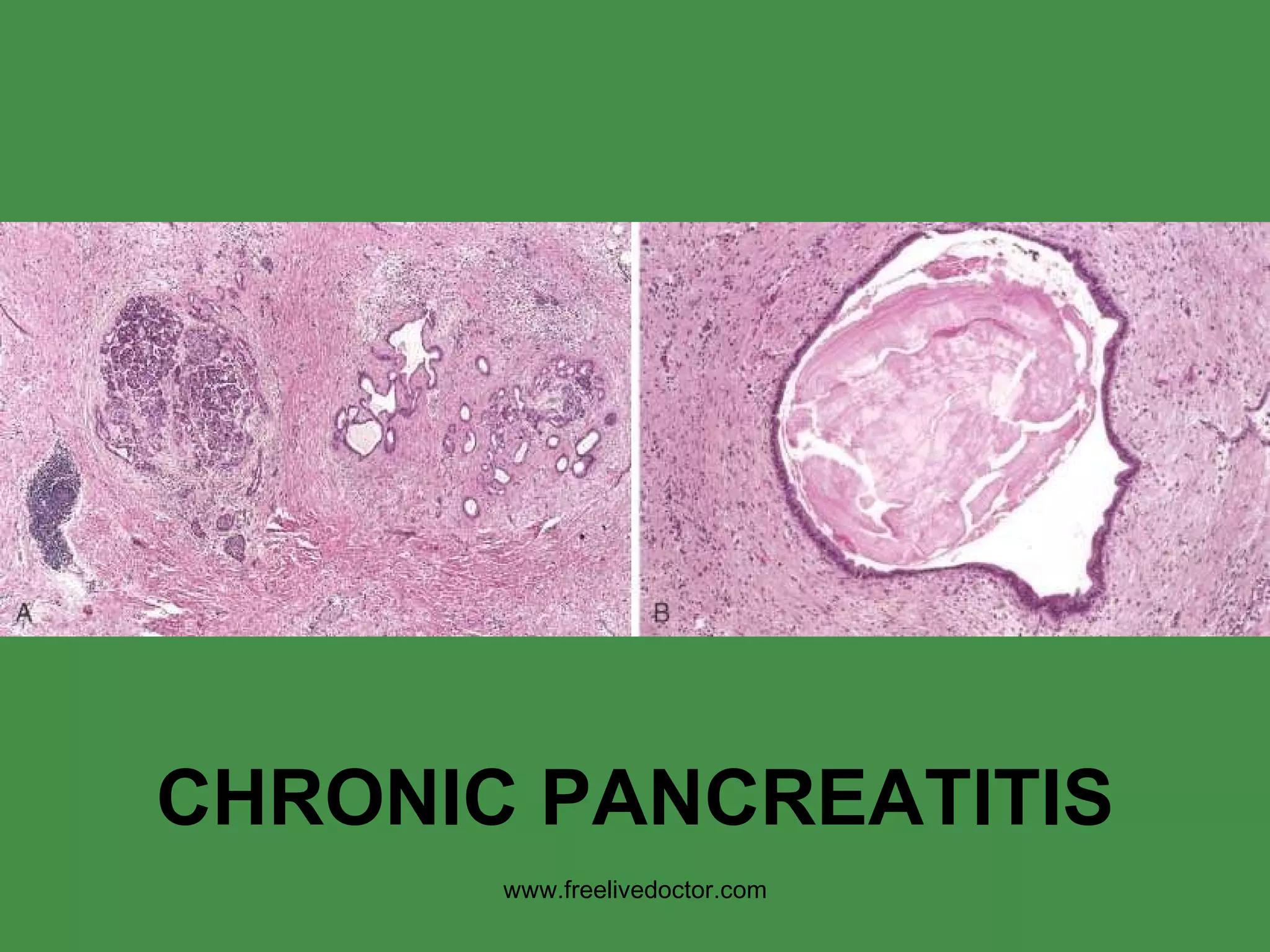 Pancreas pathology | PPT