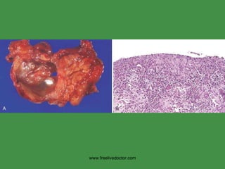 Pancreas pathology | PPT