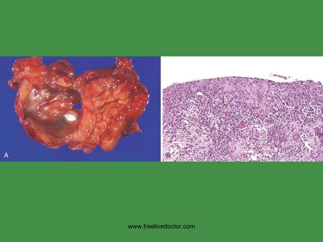 Pancreas pathology | PPT