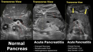 pancreas ppt.pptx
