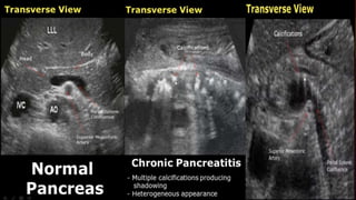 pancreas ppt.pptx