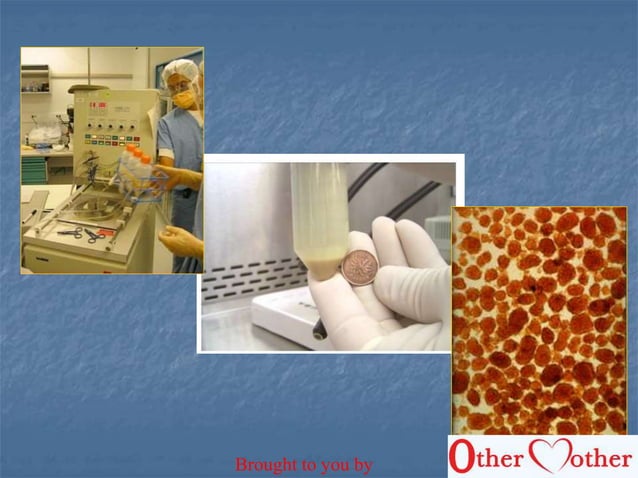 Pancreas transplantation | PPT | Endocrine and Metabolic Diseases ...