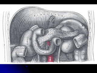 pancreas trauma.ppt