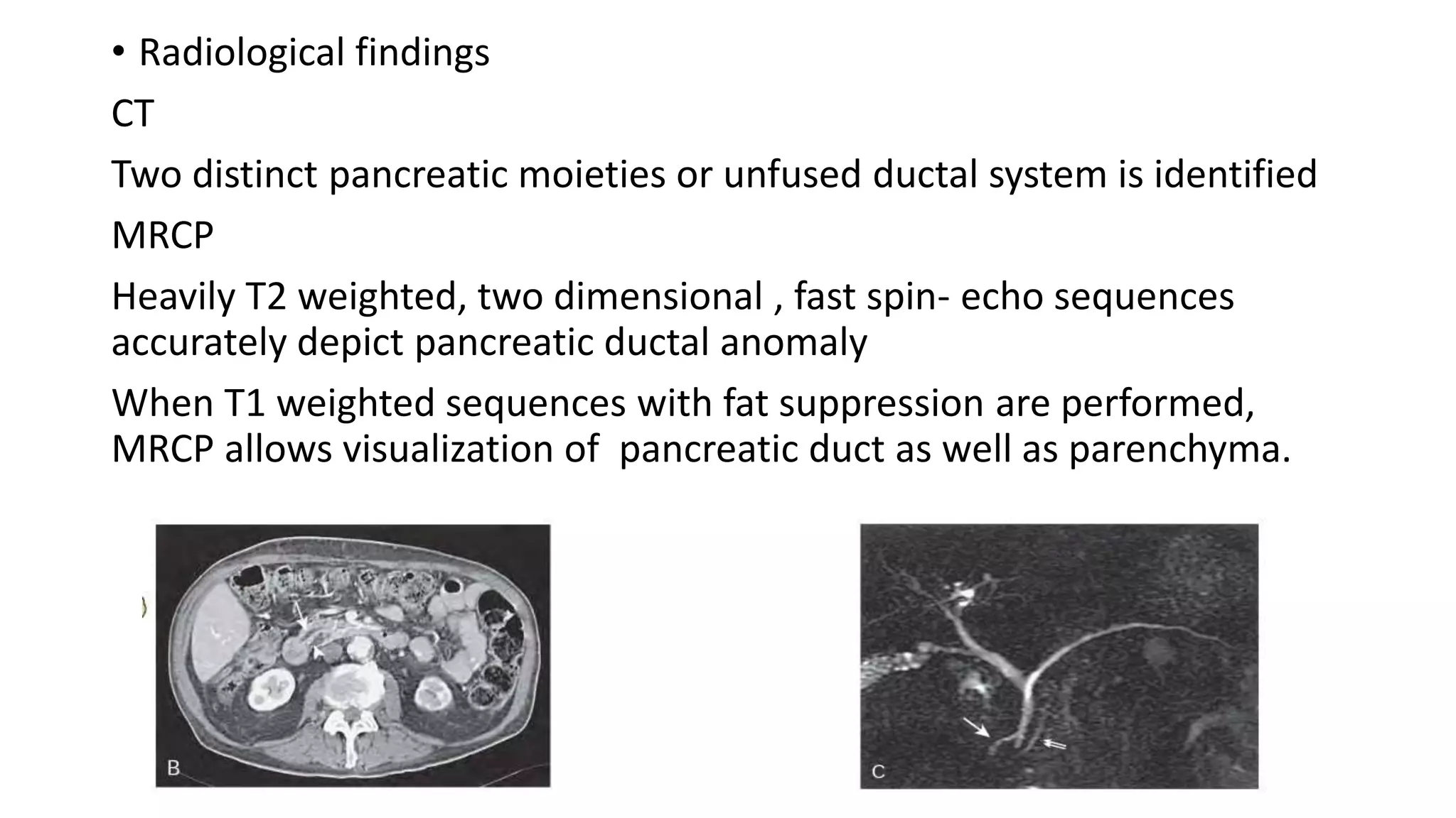 Pancreas RADIOLOGY | PPTX
