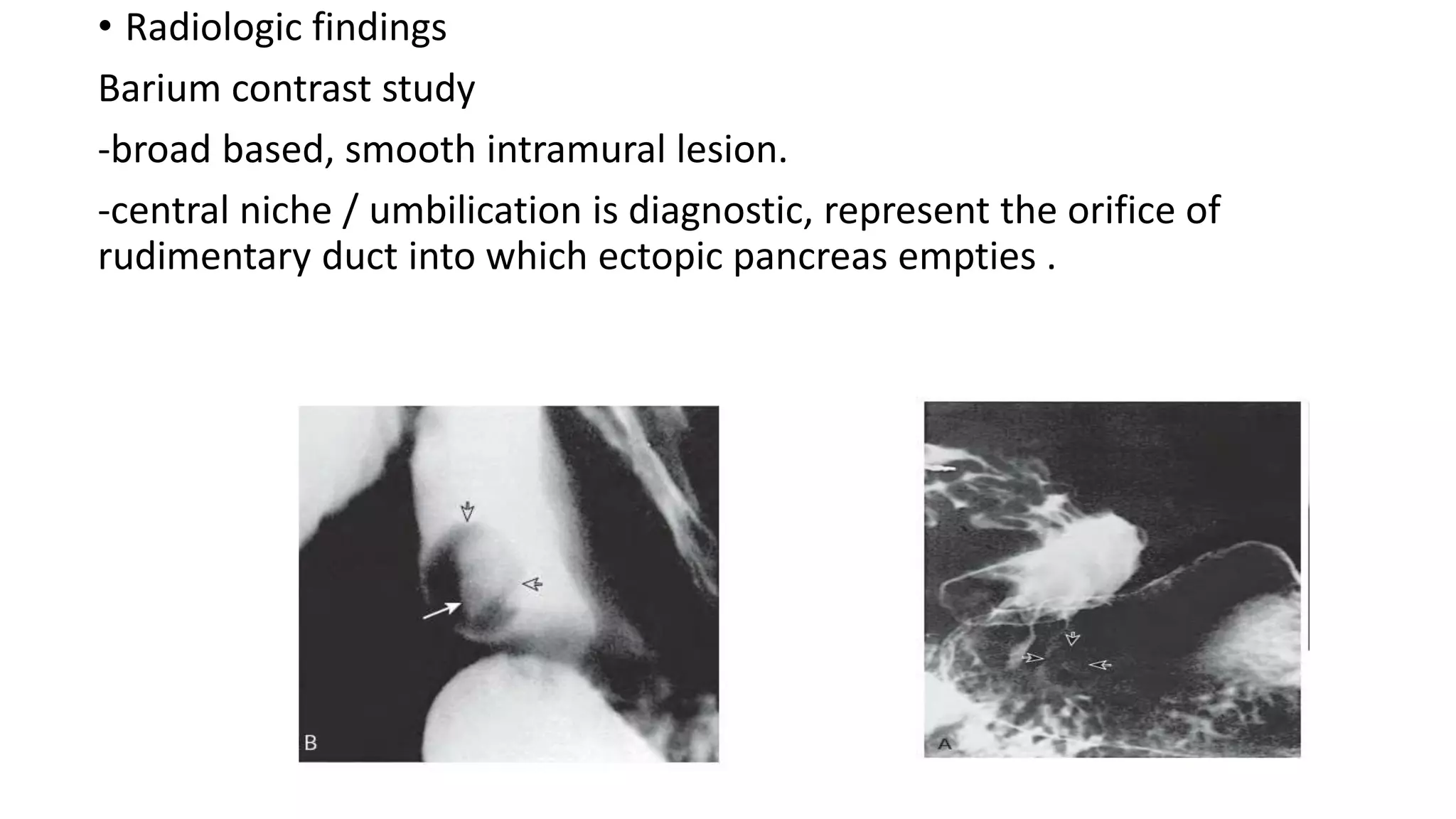 Pancreas RADIOLOGY | PPTX