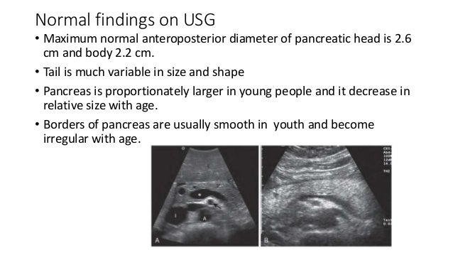 Pancreas RADIOLOGY