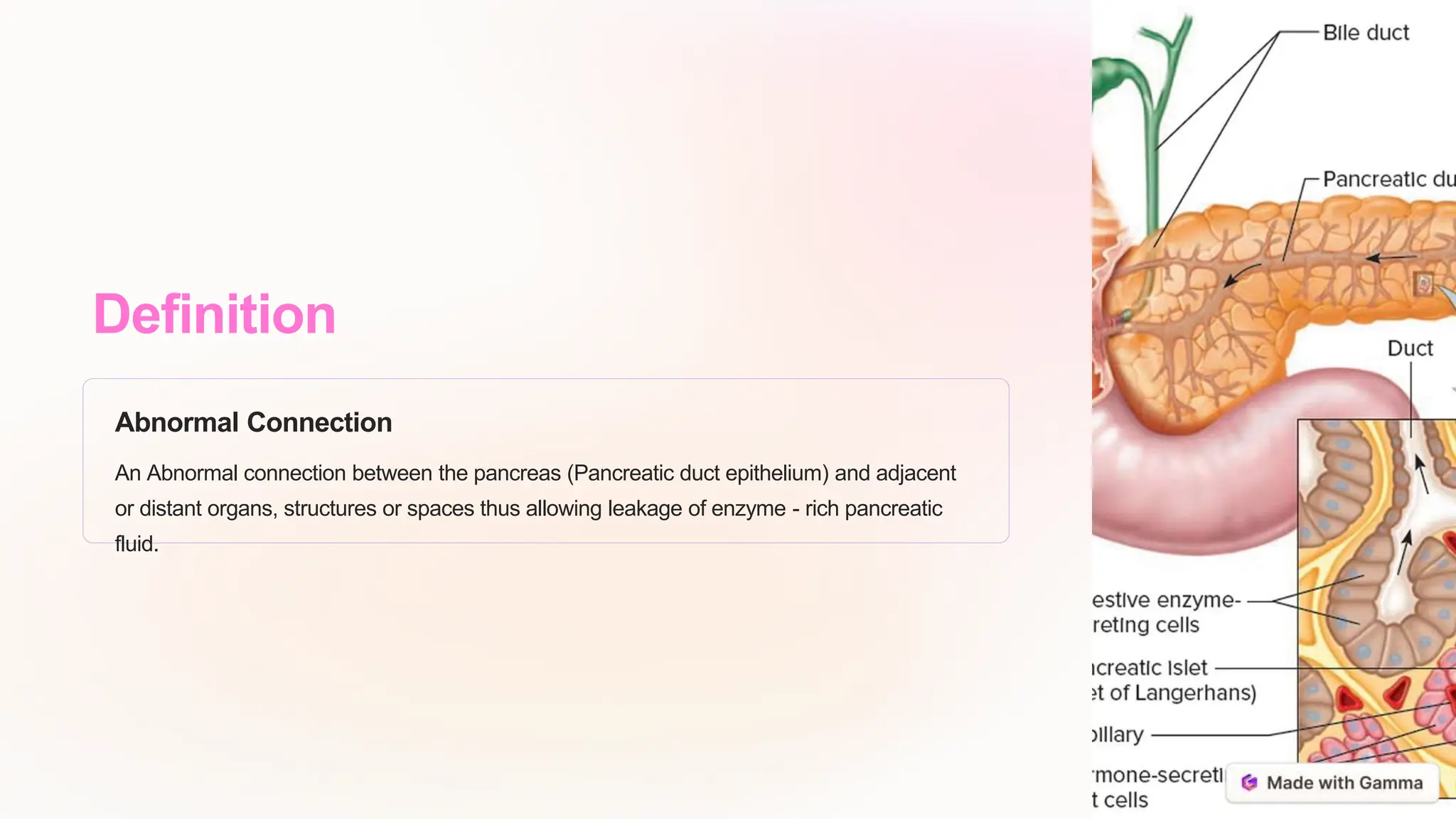 Pancreatic-Fistulas, Etiology, Pathogenesis, Clinical picture | PPTX