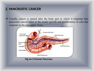 Interpretation and Management of Pancreatic cancer | PPTX