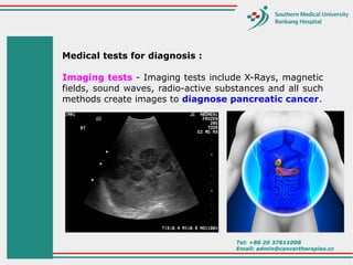 Diagnosis of Pancreatic Cancer | PPT